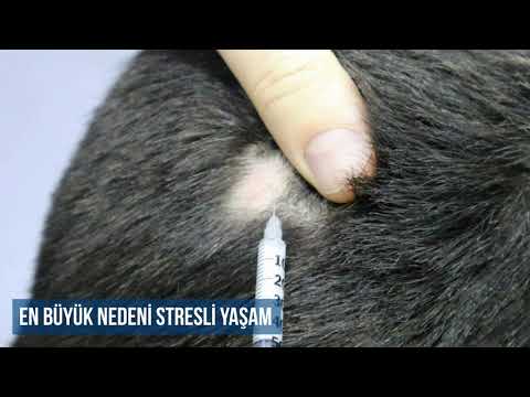 7M Hastanesi - Saçkıran (Alopesi Areata)