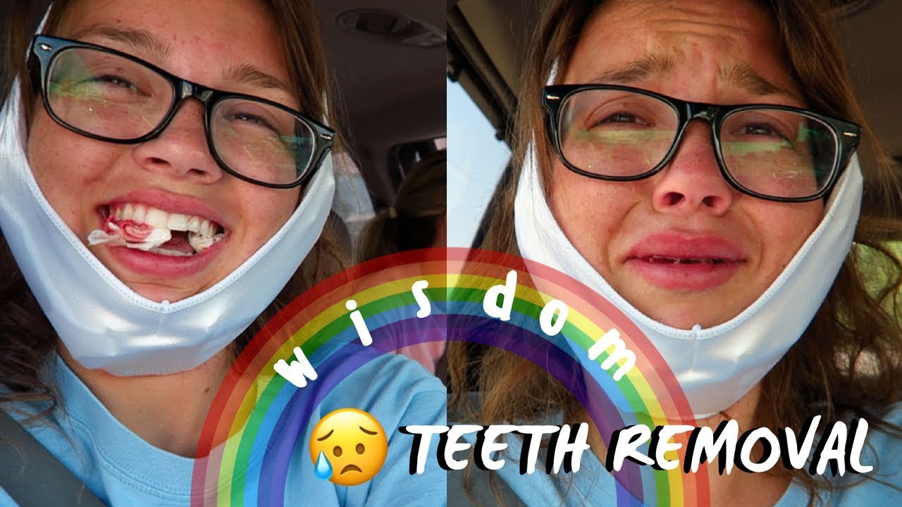 wisdom teeth removal *funny reaction* - YouTube