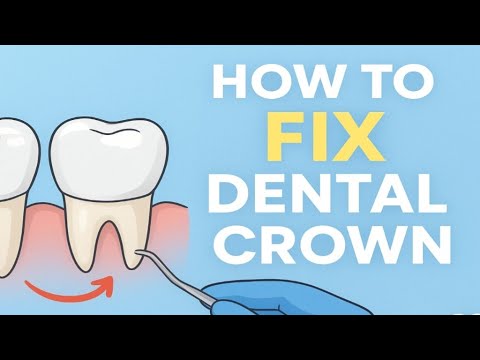 Live Dental Crown fixing - YouTube