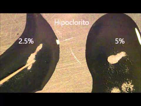 Comparativo de HIPOCLORITO DE SODIO al 5% y al 2.5% Endodoncia ...