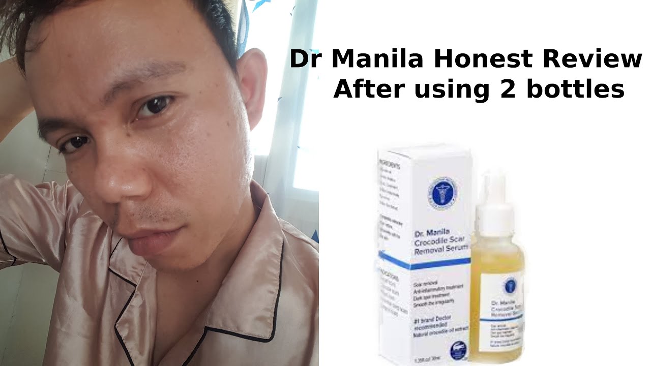 Honest Review after using 2 Bottles | Dr Manila Crocodile Serum - YouTube