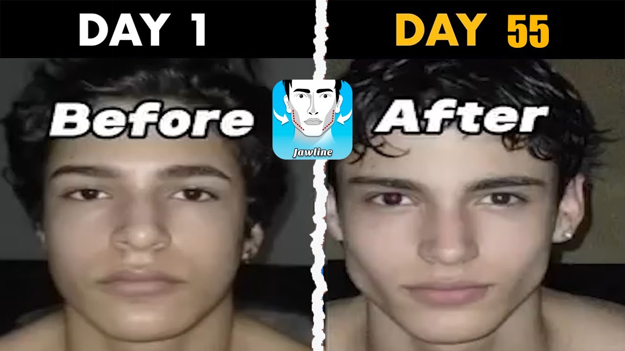 How to Get a Sharp Jawline Fast | Jawline Exercises for Men & Women ...