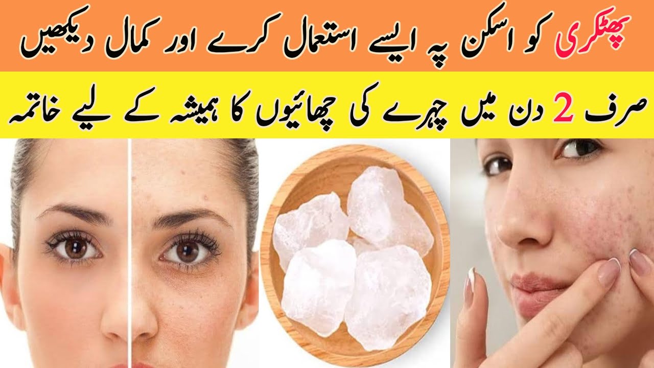 Alum and Aloe vera Magic | Fitkari and Aloe Vera | say good bye to ...