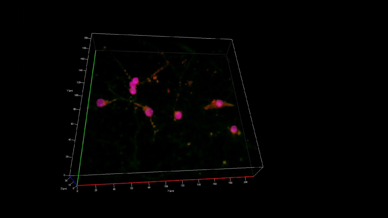 CurcuEmulsomes on laser axotomy-induced CNS injury model ...