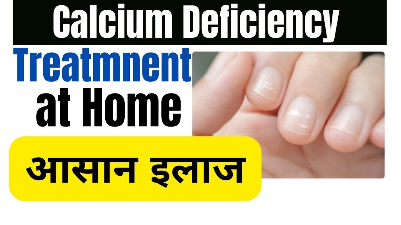 Calcium deficiency treatment at home | calcium ki kami kaise dur kare ...