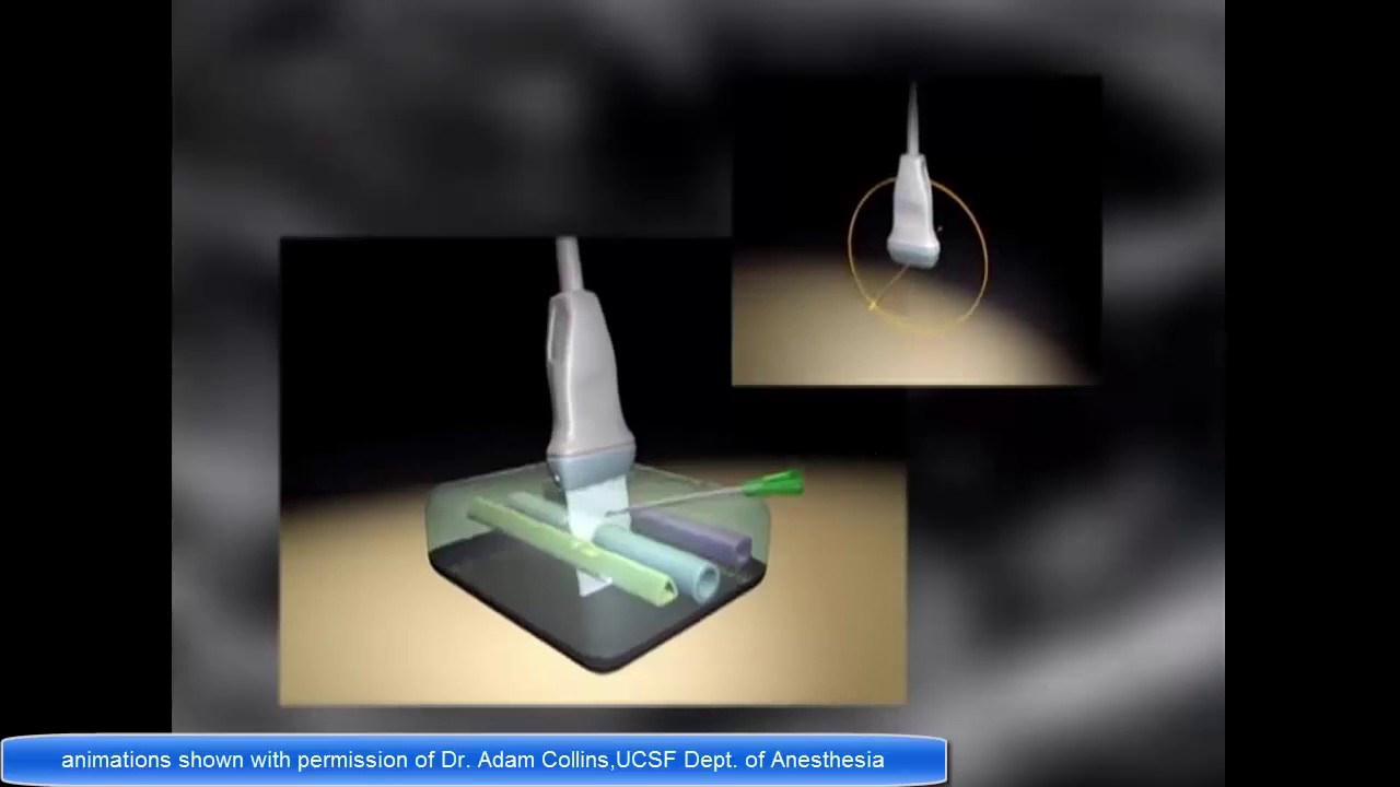 Introduction to Ultrasound with eFAST - YouTube