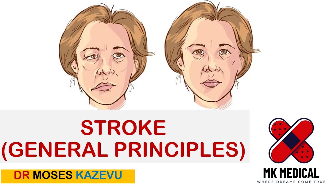 Stroke || General Principles || Part 1 - YouTube
