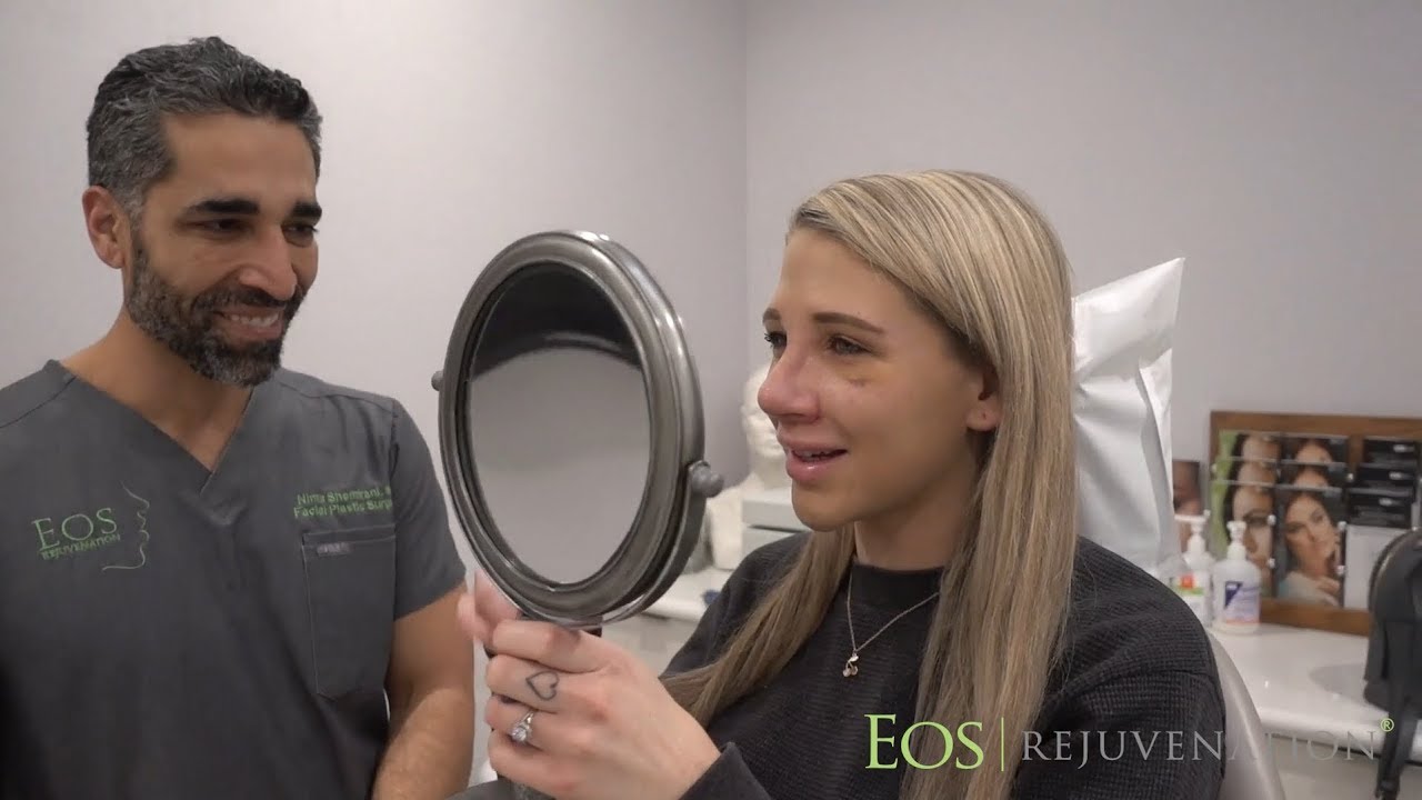Rhinoplasty + Lip Lift Reveal - YouTube
