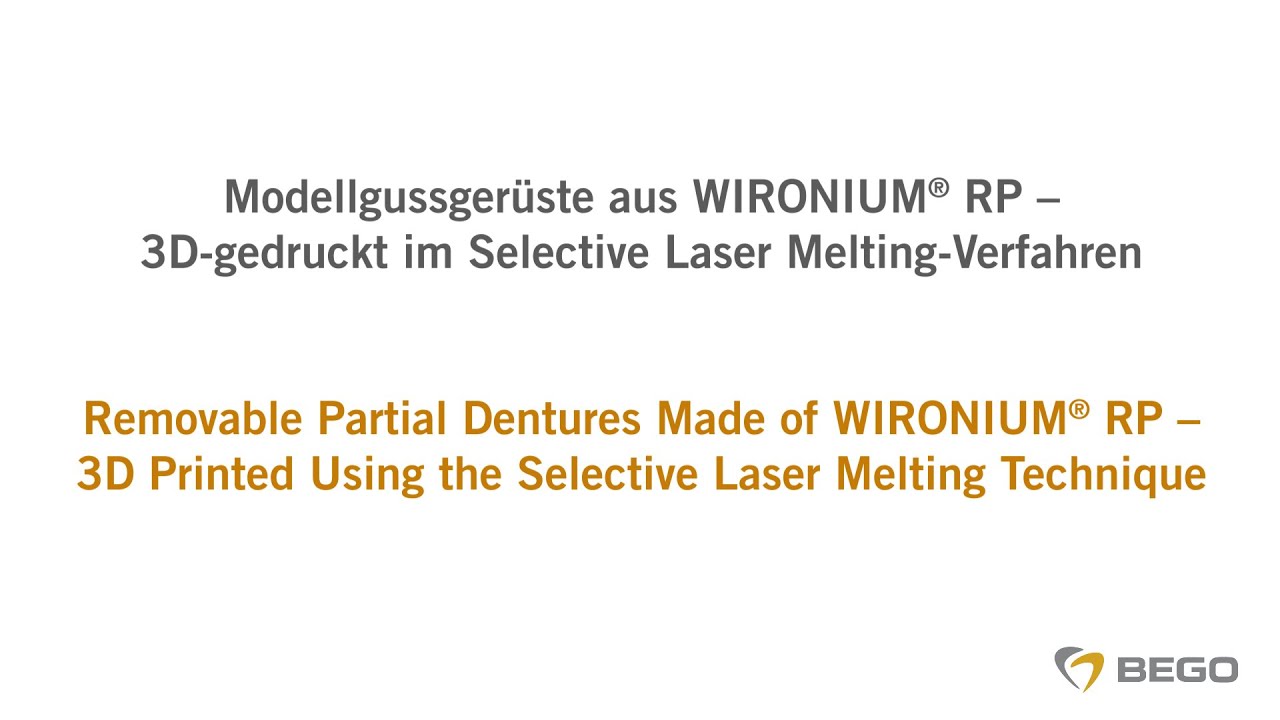 BEGO Selective Laser Melting – Removable Partial Denture Frameworks ...