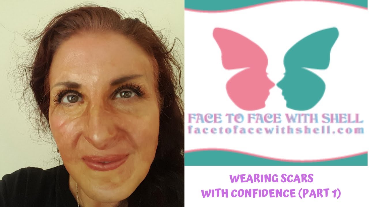 WEARING SCARS WITH CONFIDENCE (PART 1) - YouTube