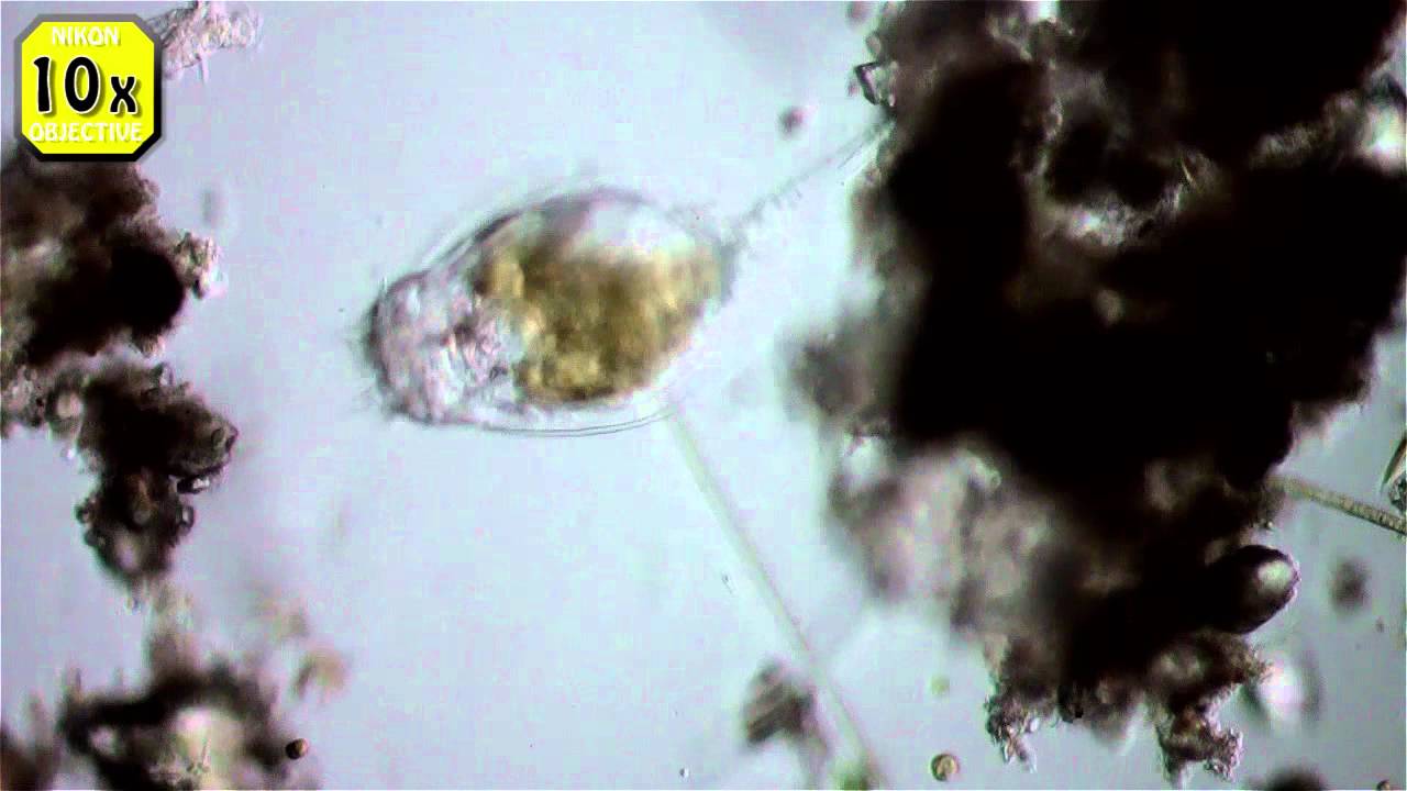 Euchlanis dilatata - A Rotifer - YouTube