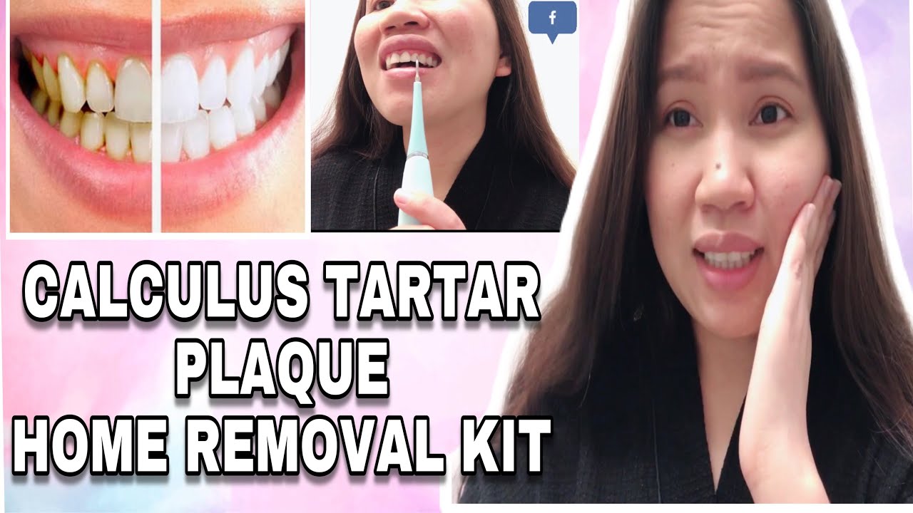 HOW TO REMOVE CALCULUS TARTAR PLAQUE AT HOME | ItsSarahG T - YouTube