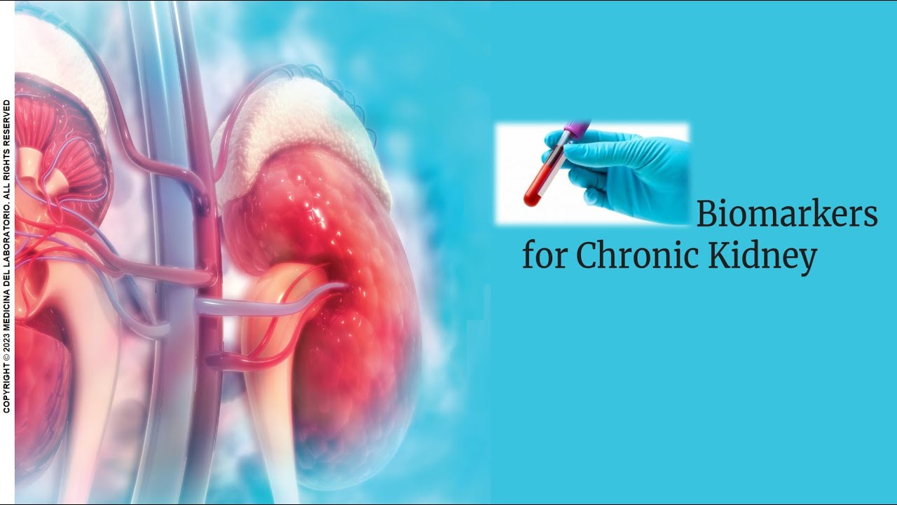 El correcto PERFIL RENAL para el diagnóstico de la enfermedad renal ...