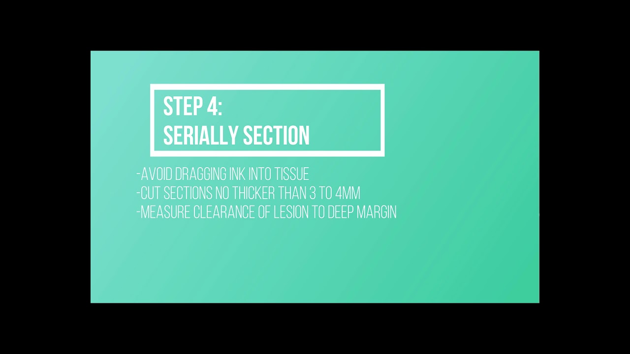 How to Gross Skin Excision Specimens - YouTube