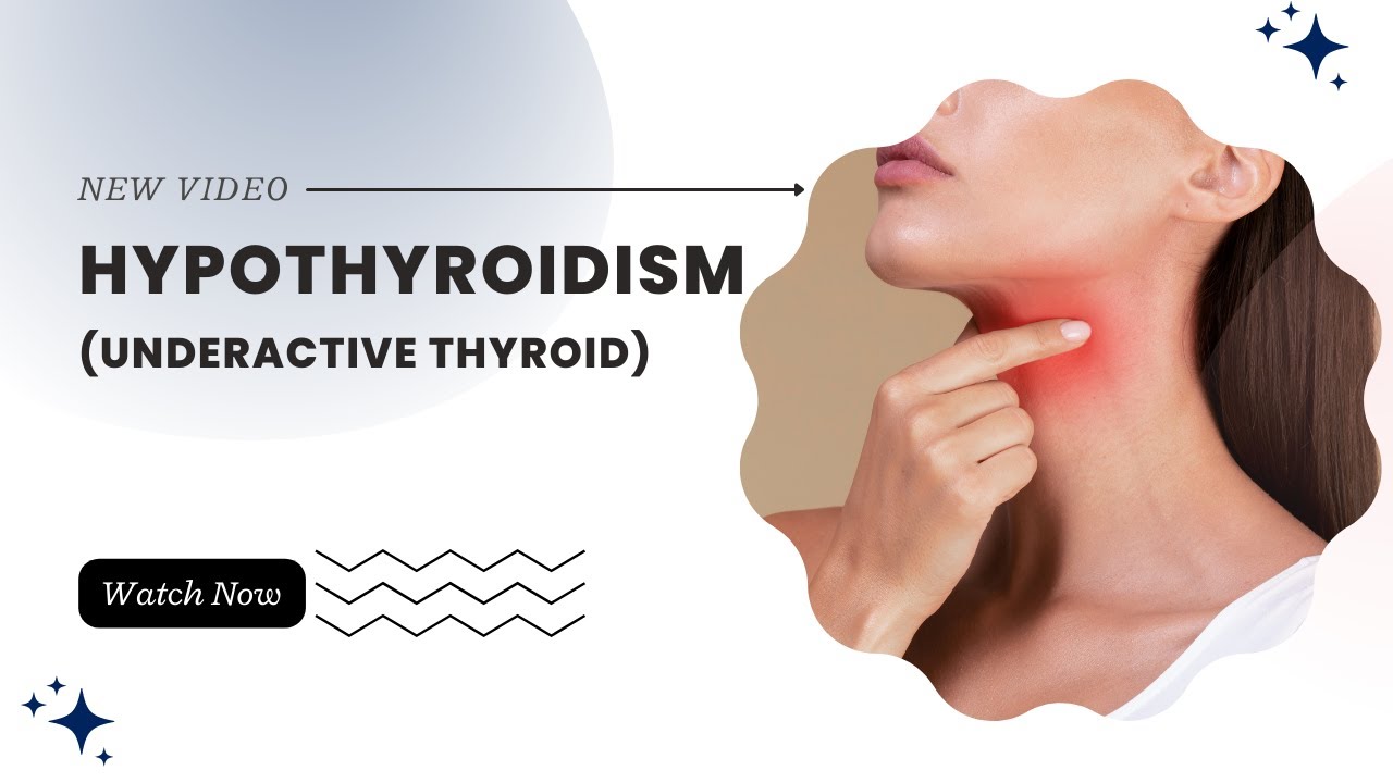 HYPOTHYROIDISM SIMPLIFIED: A VISUAL GUIDE TO THE BASICS - YouTube