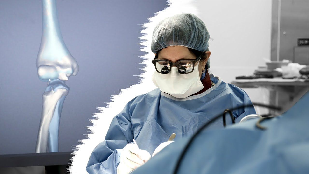 Why Virtual 3D Planning is Crucial to Orthopedic Surgery at Yale - YouTube