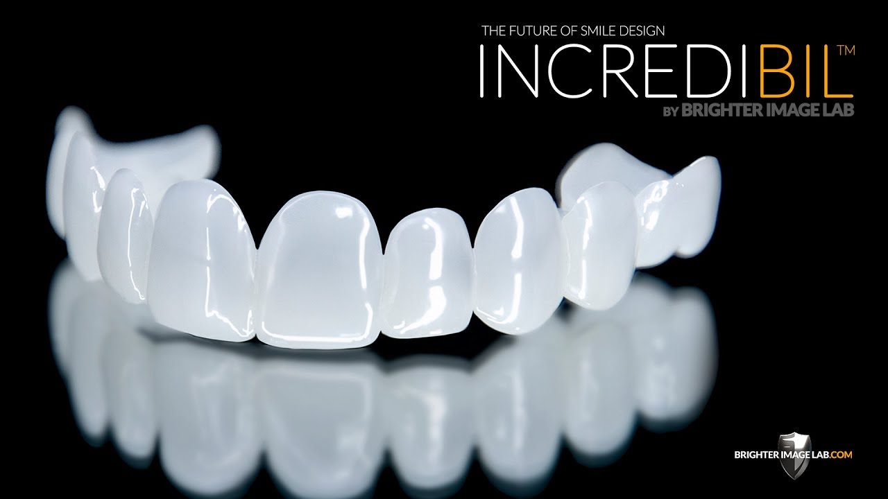 IncrediBIL Veneers® Better Than a Cosmetic Dentist? Smile ...