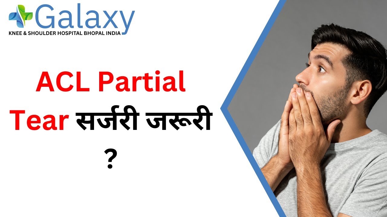 What to do for ACL Partial Tear ( How to fix ACL Partial Tear ) ACL ...