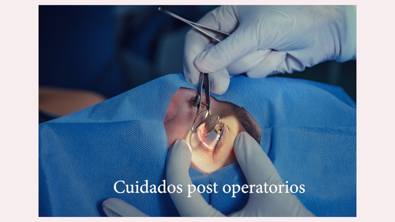 #3 Cuidados post operatorios de catarata de ojo. El Dr. Mena nos ...