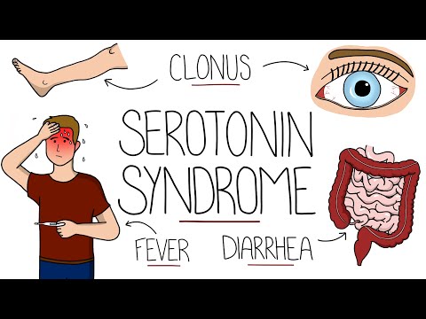 Serotonin Syndrome Explained (Serotonin Toxicity)
