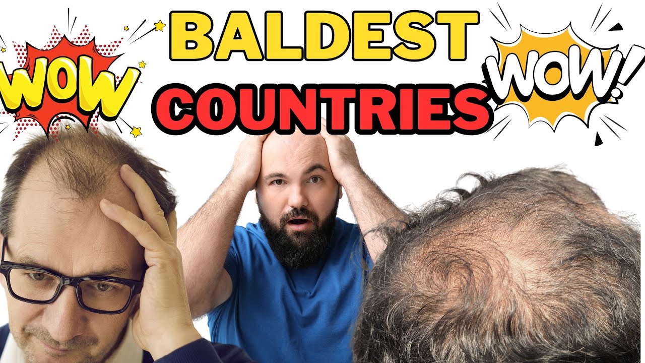 Top 10 Countries with the Most Balding Men | Embrace the Baldness ...