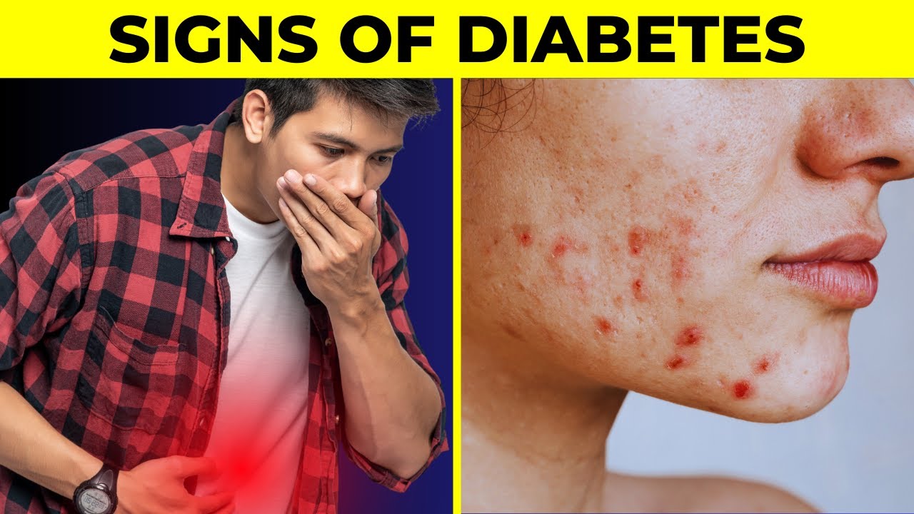12 Early Signs & Symptoms Of Diabetes You Need To Look Out For - YouTube