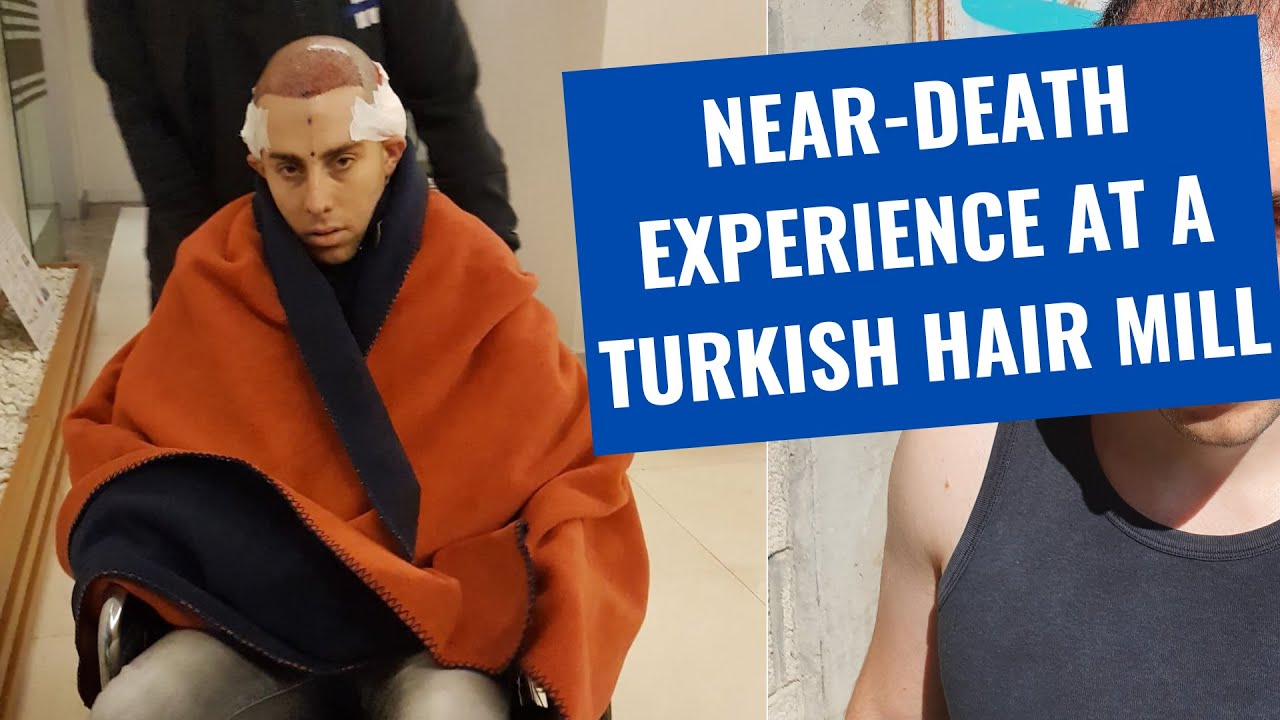 Hair-mills of Turkey - A Horror Story From ArenaMed - YouTube