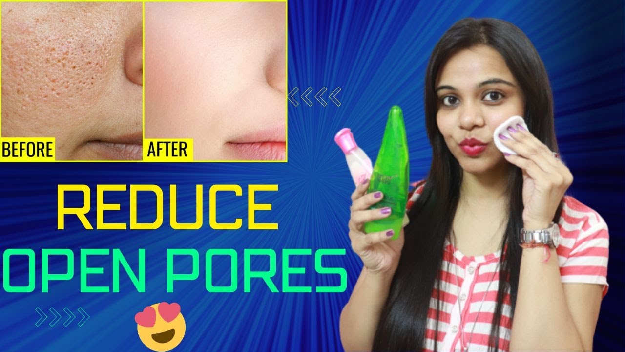 REDUCE OPEN PORES Naturally | SuperBeautyDezires - YouTube