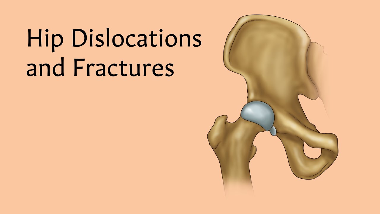 Hip Injuries | AnatomyStuff - YouTube