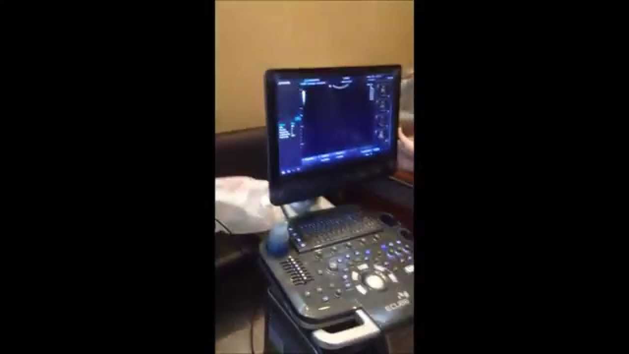 المقطع الأول لمحة عامة عن الجهاز Alpinion Ecube 7 - YouTube