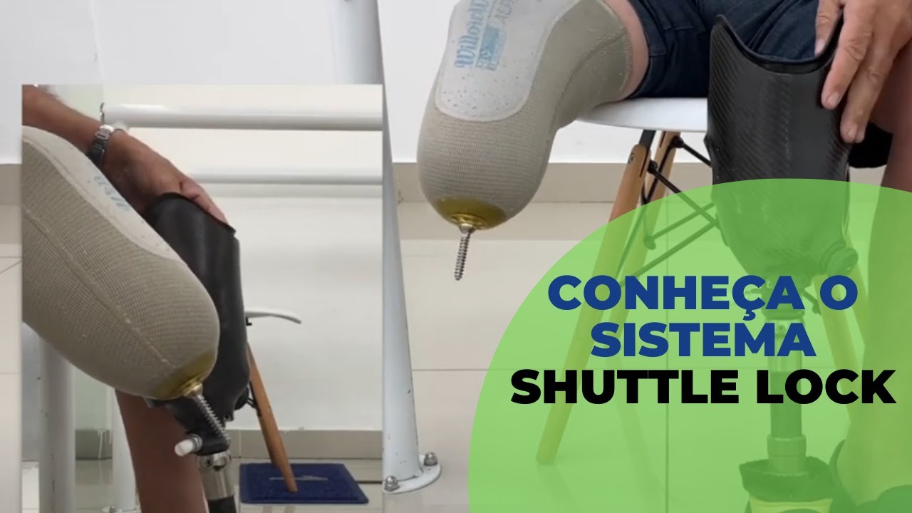 Shuttle Lock: Conheça o Revolucionário Sistema para Prótese Perna - YouTube