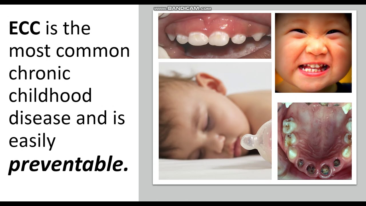 ECC - YouTube