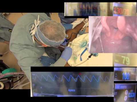 Introes Pocket Bougie with Glidescope and Bronch Adapter - YouTube