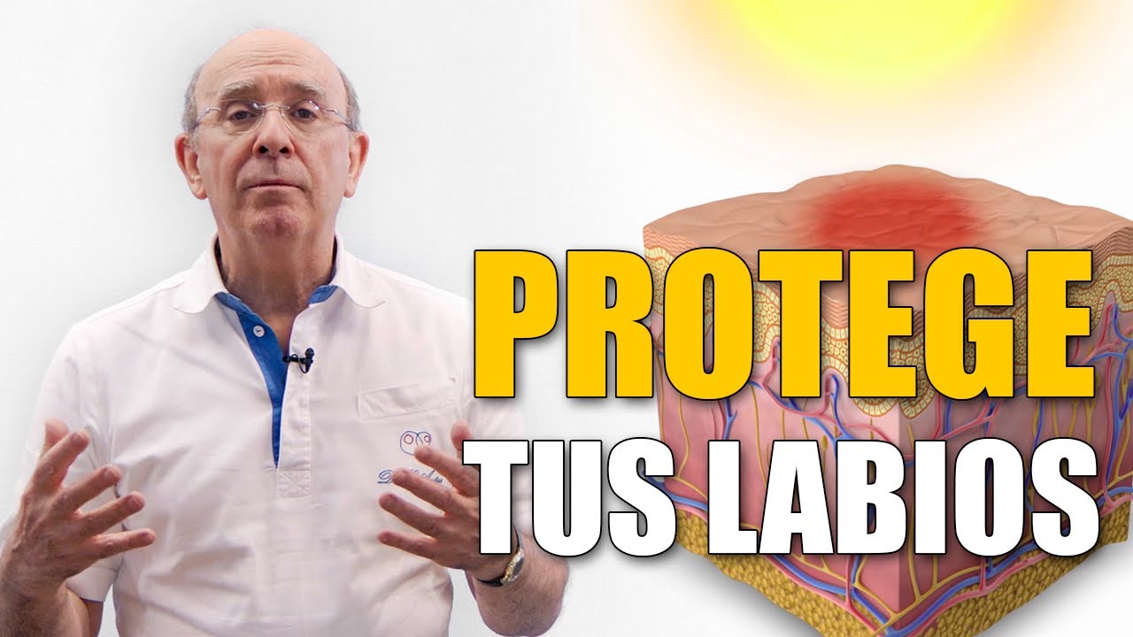 Labios quemados por el sol: cómo evitarlo - YouTube