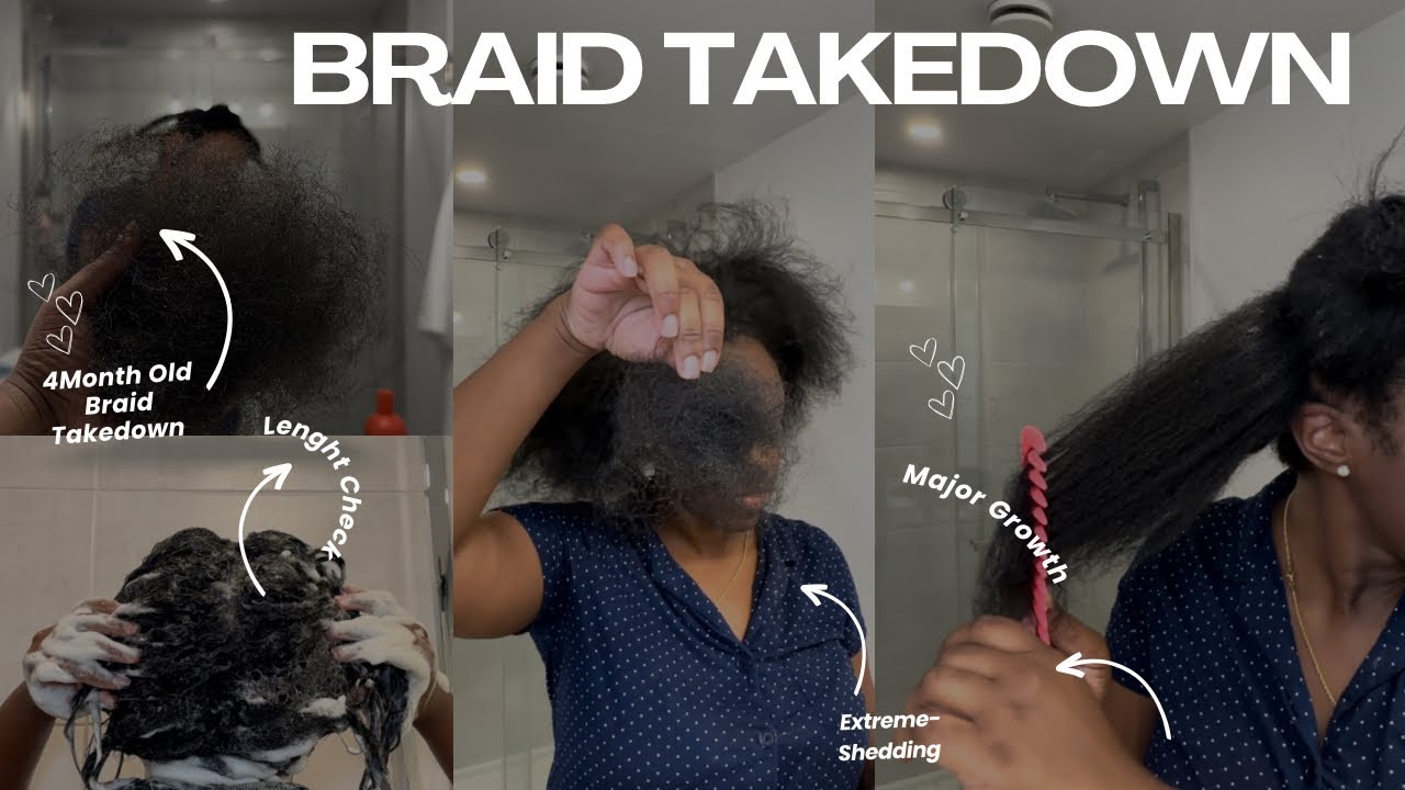 4 MONTH OLD BRAID TAKEDOWN🤮|HAIR LOSS|HAIR DETANGLING - YouTube