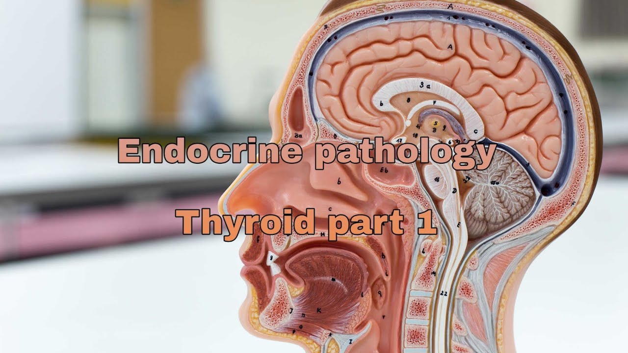 Endocrine pathology Thyroid Part 1. - YouTube