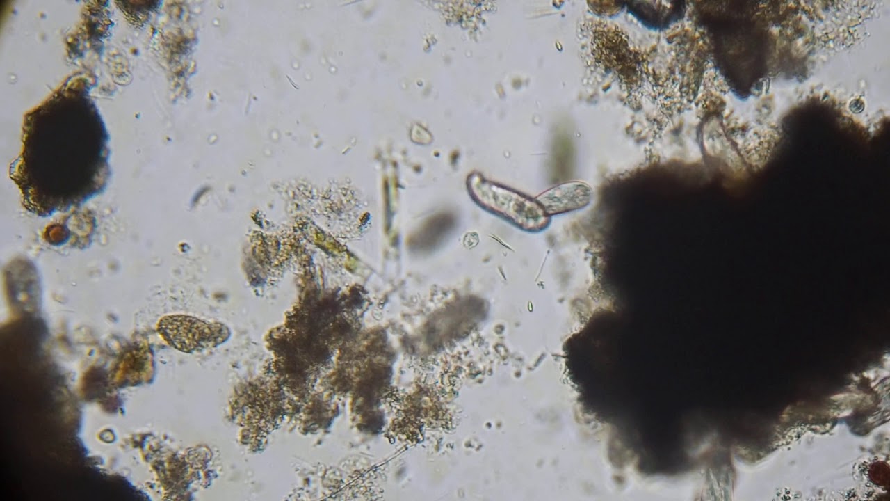 Colpidium colpoda - Orzęski - YouTube