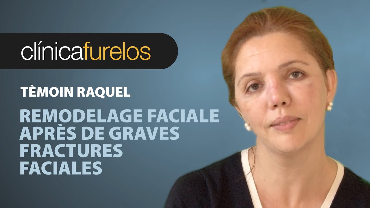 Raquel. Remodulation faciale après de graves fractures faciales - YouTube