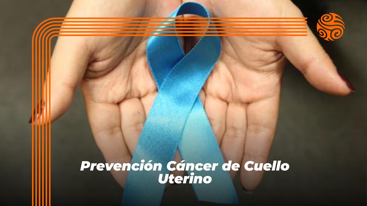 Prevención Cáncer de Cuello Uterino con el Doctor. Wilson Cubides - YouTube