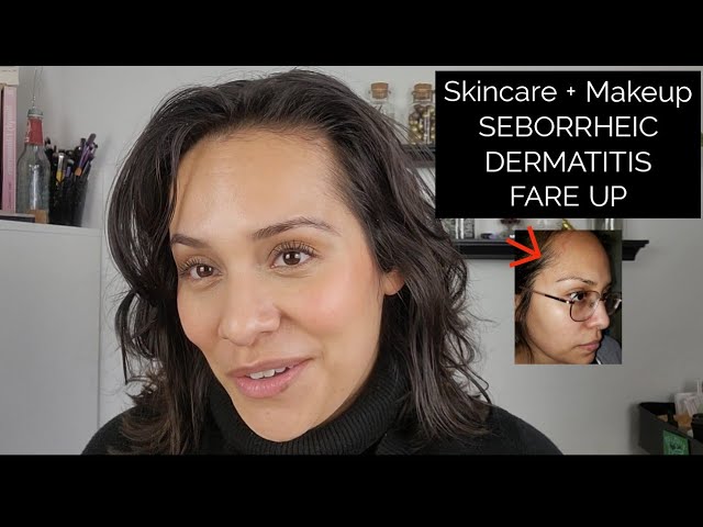 Best Makeup For Dermatitis | Saubhaya Makeup