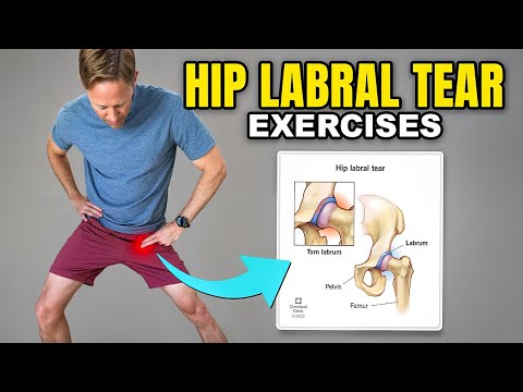 Hip Labral Tear Exercises