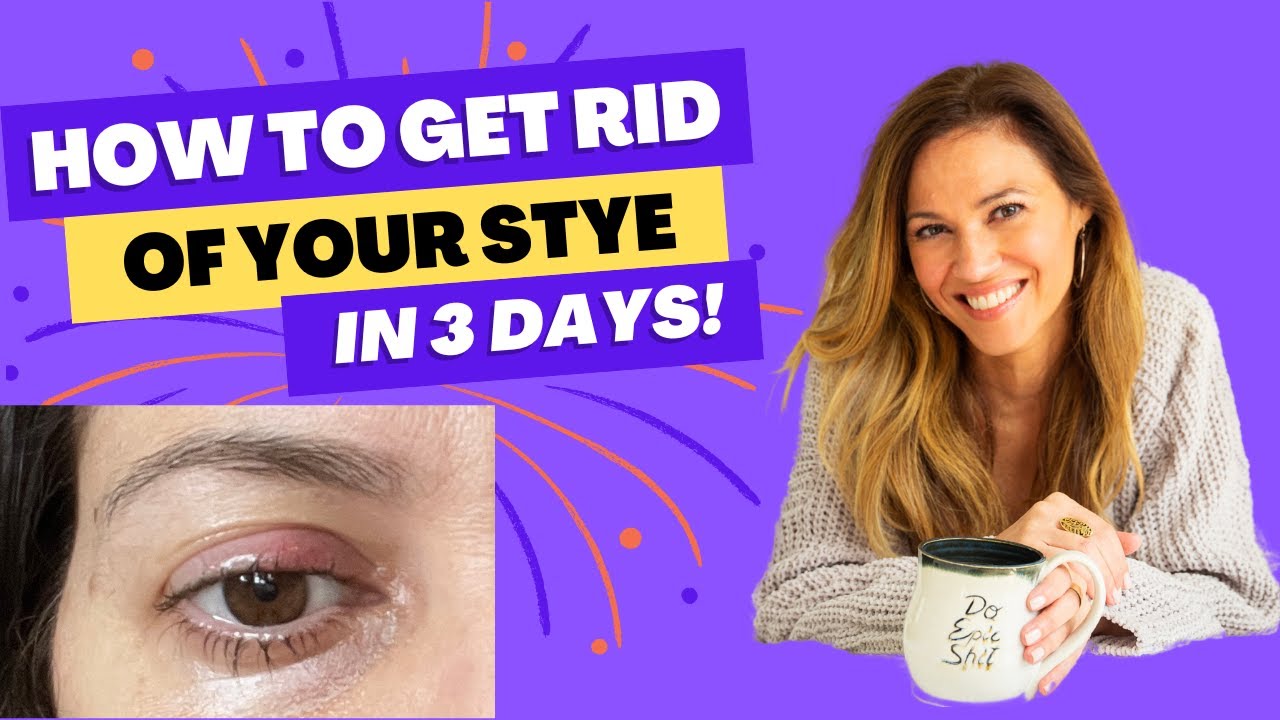 How to GET RID of a STYE in 3 DAYS! - YouTube