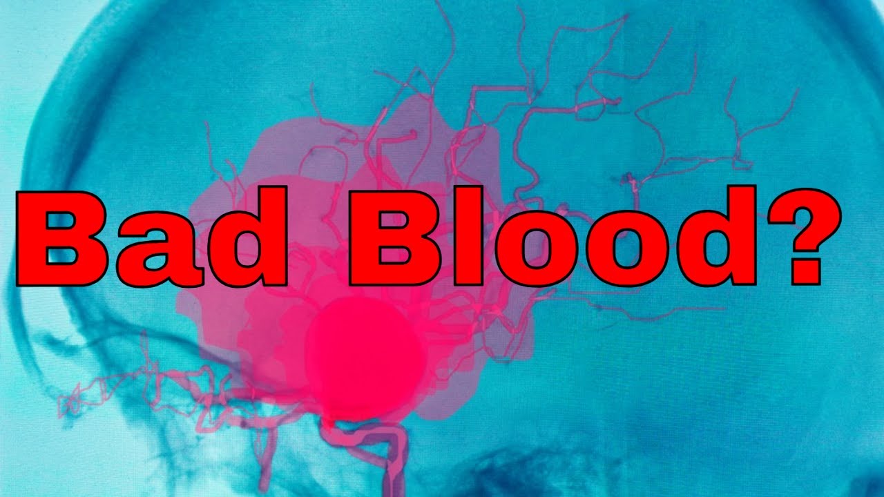 Bad Blood? Brain Bleed Syndrome May Turn Out to be Infectious - YouTube