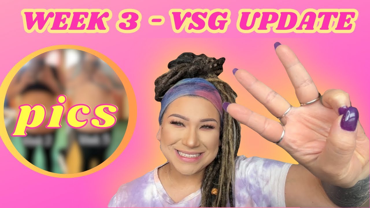 VSG SURGERY | WEEK 3 POST OP | VERTICAL SLEEVE GASTRECTOMY - WEIGHT ...