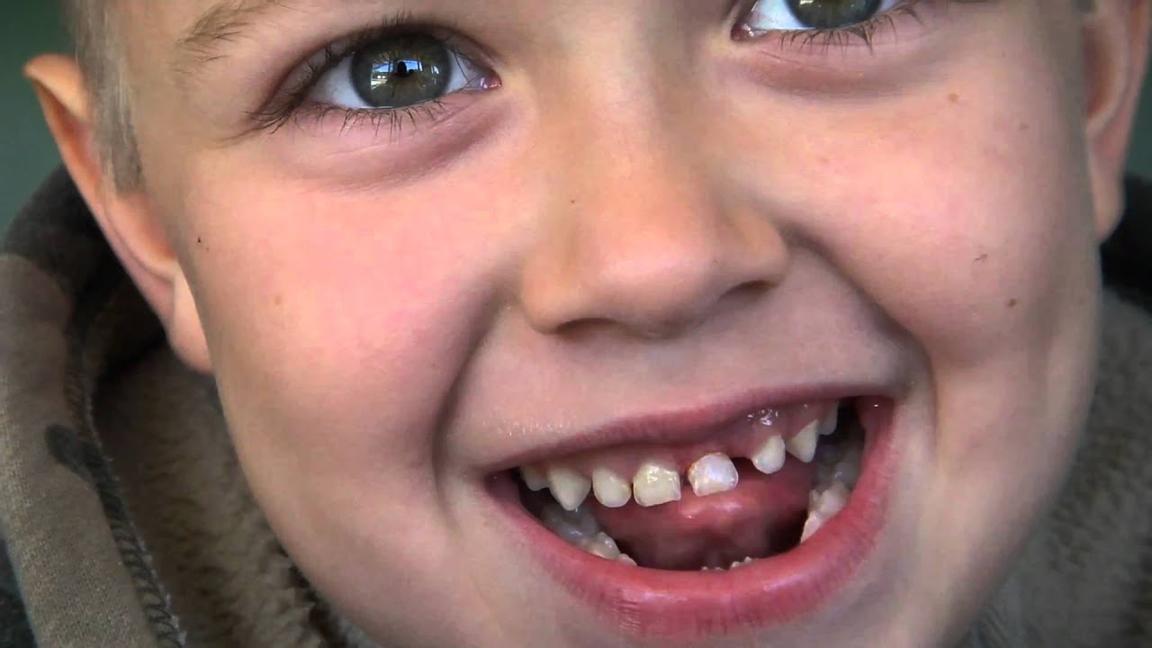 Boys are gross... loose teeth even more so - YouTube