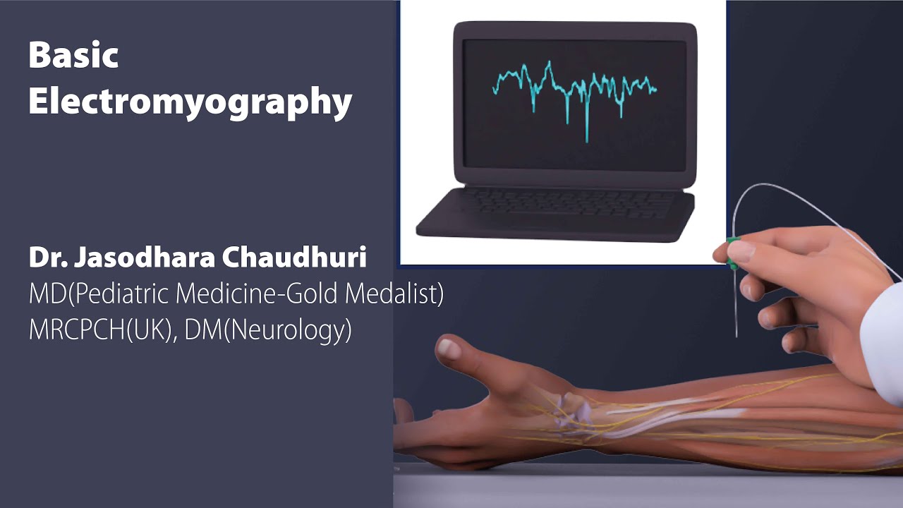 Basic Electromyography - YouTube