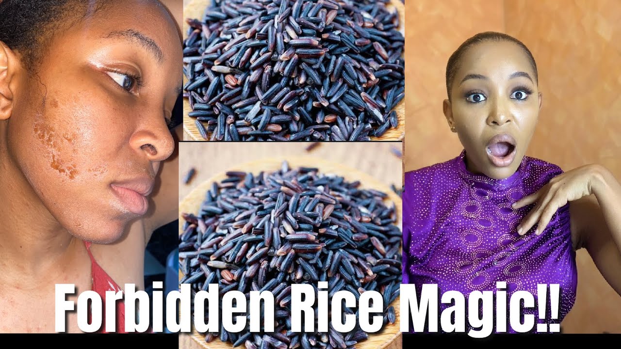 BLACK RICE RUINED MY SKIN| USING BLACK RICE FOR ONE MONTH - YouTube