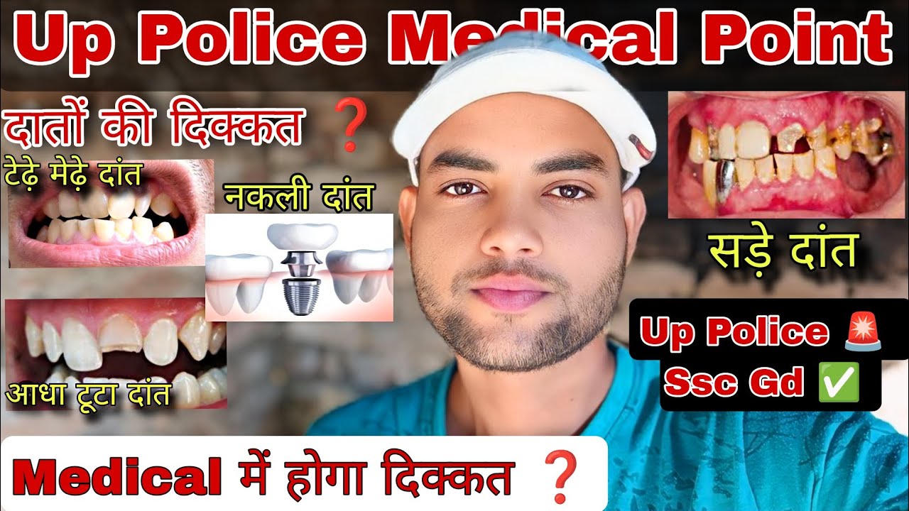 Medical में दांतों की दिक्कत | Up Police Medical Point | Up Police ...