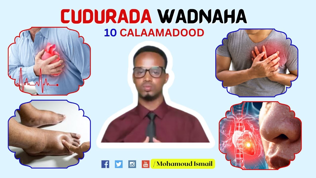 Cudurada Wadnaha Ku Dhaca | 10 Calaamadood - YouTube