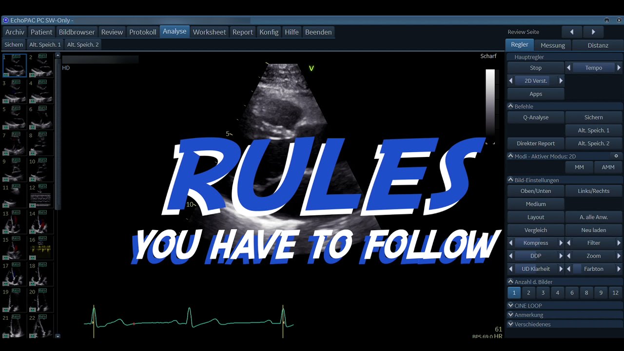 〖Echocardiography〗 Strain Imaging 1 - Basic Rules of Strain Imaging ...